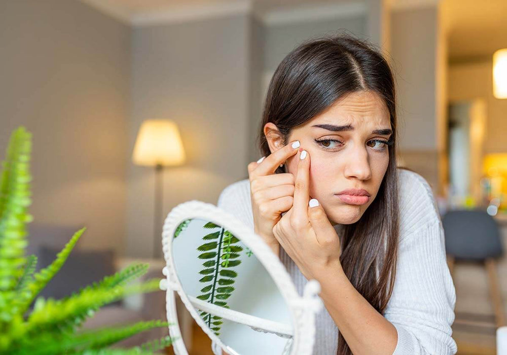 How To Get Clear Skin Naturally At Home | Kadalys